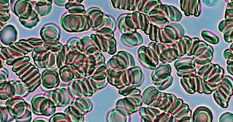 Microscopic Biological Elements in Blood - BSI International Clinics